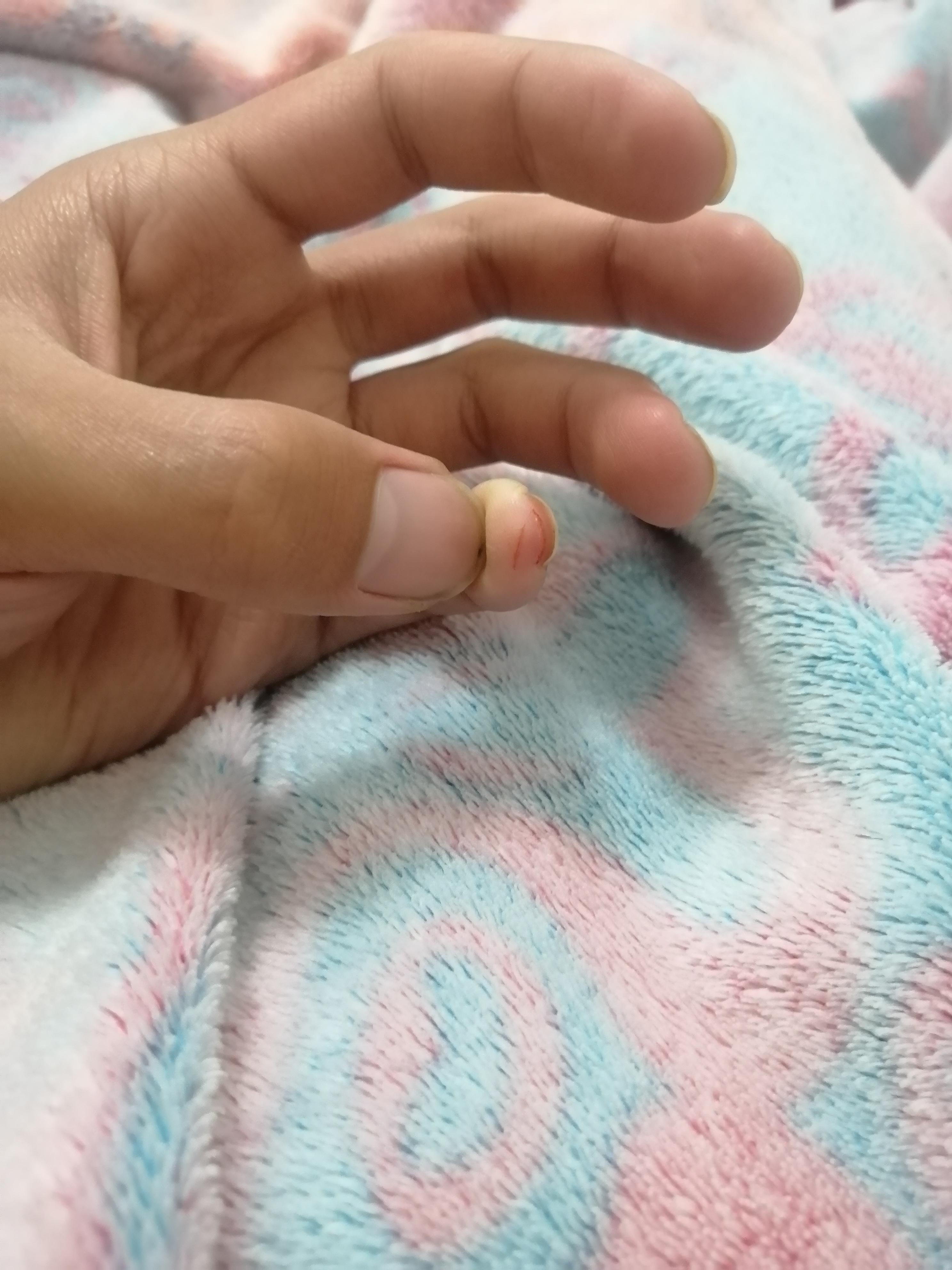 深圳打工第二天，今天... - Sunlit的动态 - TapTap